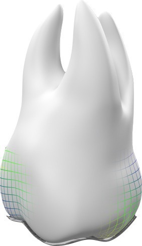 Nuevo Invisalign G8 en México | Invisalign en Ciudad de México ...