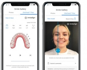 Conoce My Invisalign App, el software de las sonrisas | Invisalign en ...