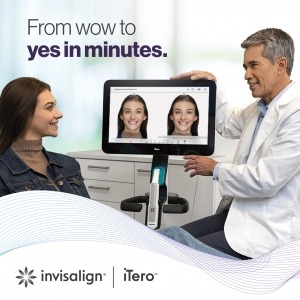 In-face Visualization, Observa Tu Nueva Sonrisa en tu Cara | Invisalign ...