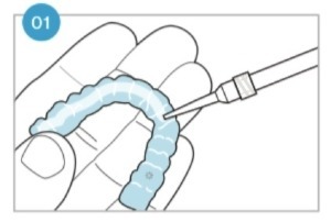 Conoce Invisalign Professional Whitening System | Invisalign en Ciudad ...