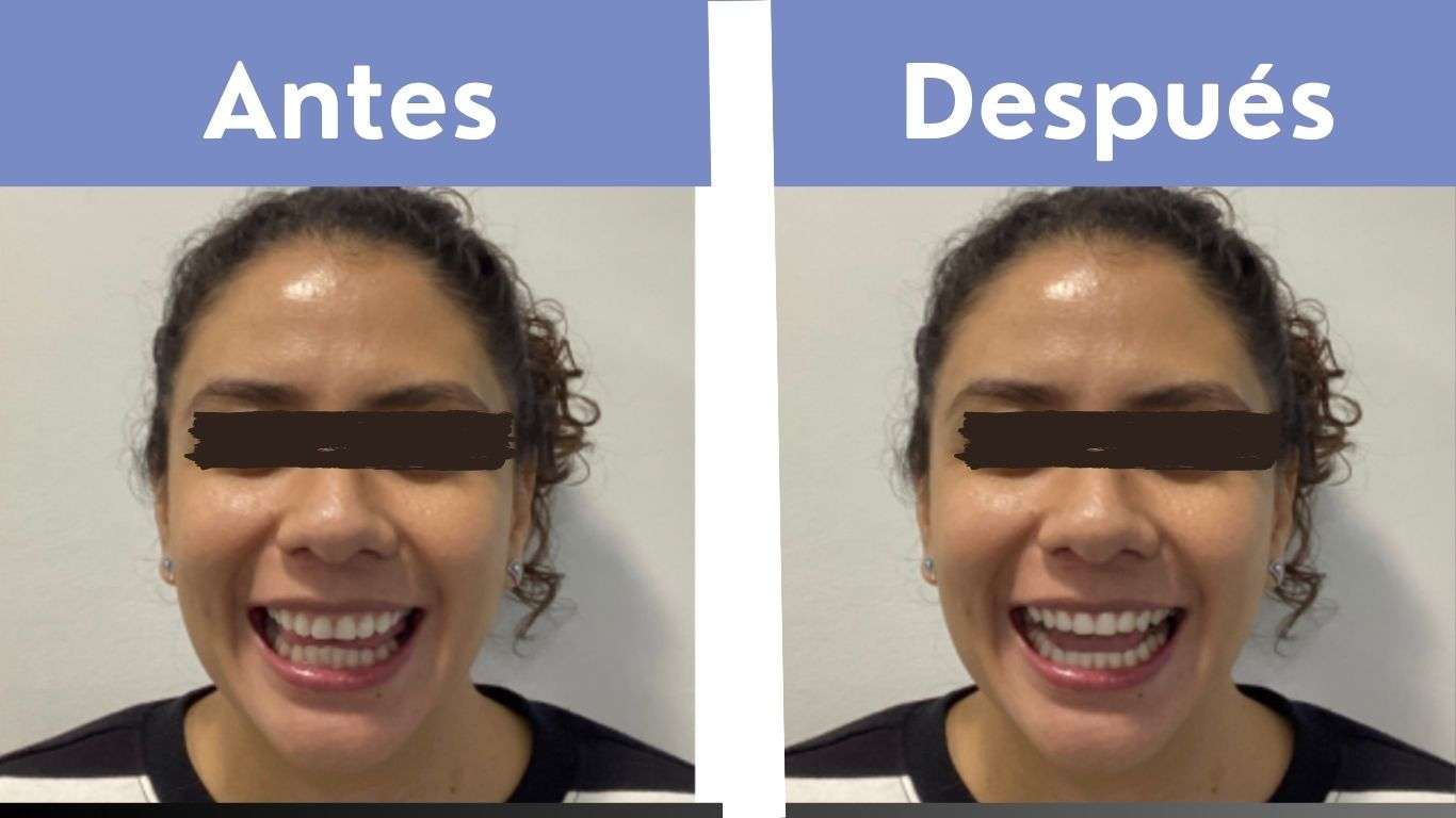 Conoce In-Face Visualization: La Nueva Experiencia en tu Tratamiento de ...