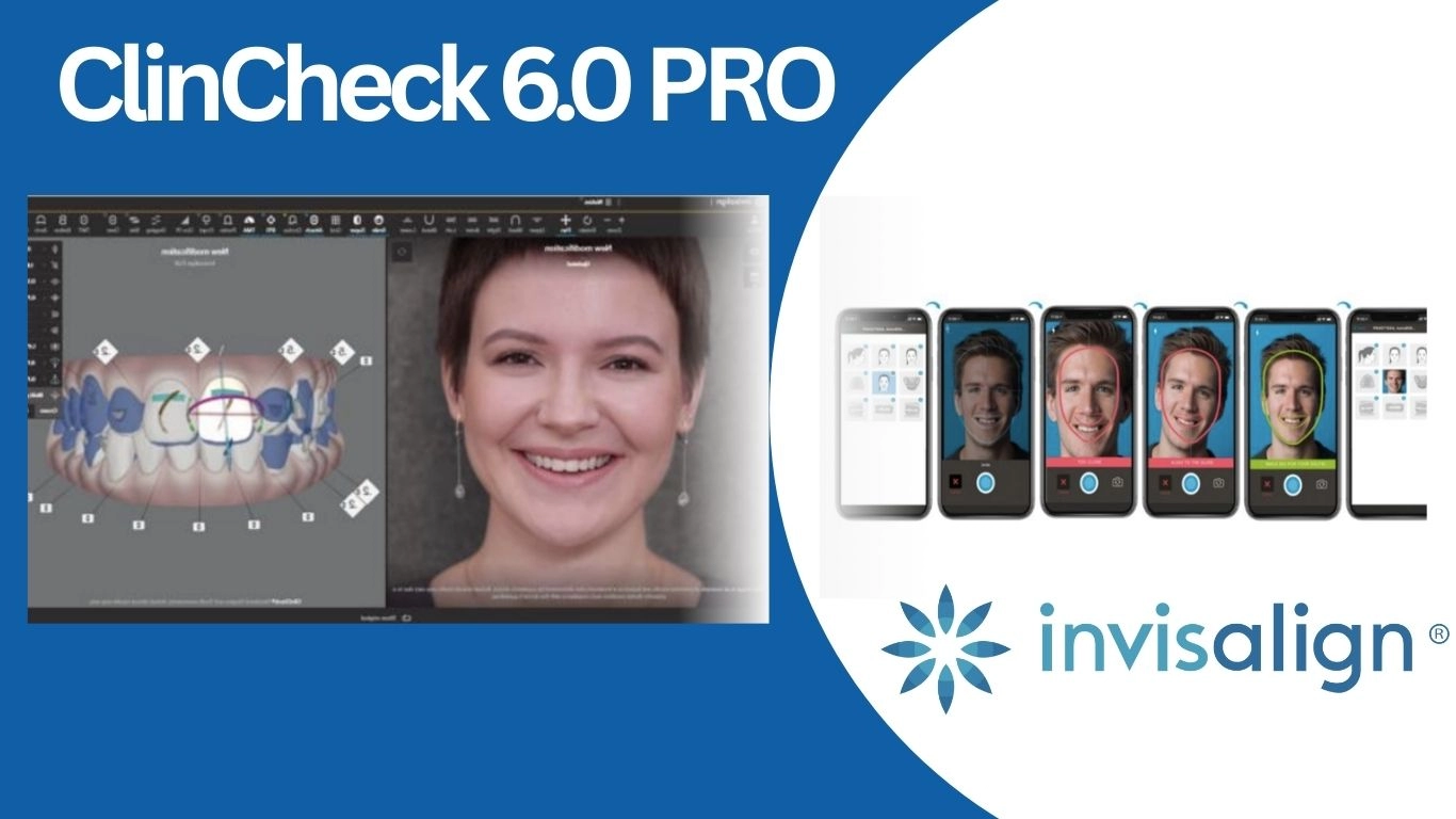 ¿Qué es ClinCheck 6.0 Pro y cómo mejora tu tratamiento con Invisalign ...