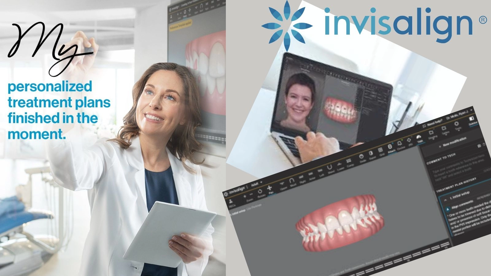 ClinCheck® Signature: La Nueva Planificación Digital de Ortodoncia ...